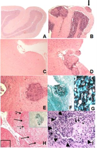 Intracranial Infection Models - Creative Diagnostics