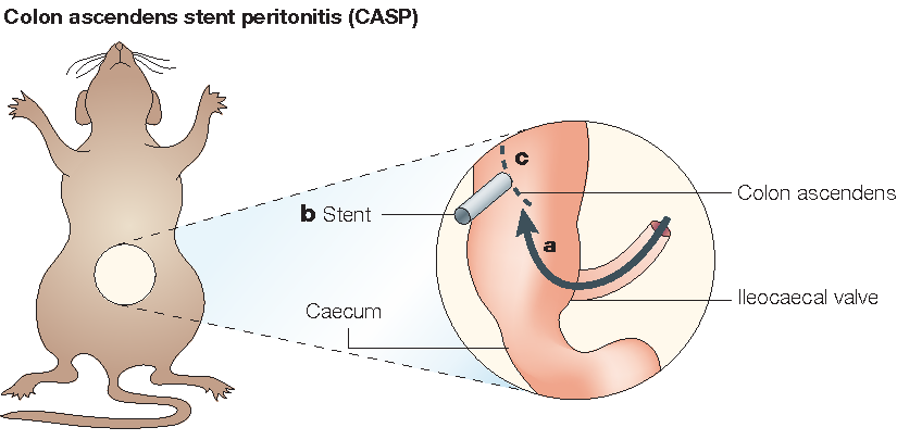 CASP Sepsis Model Services - Creative Diagnostics