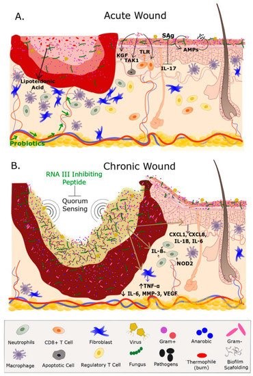 Deep Wound Model - Creative Diagnostics
