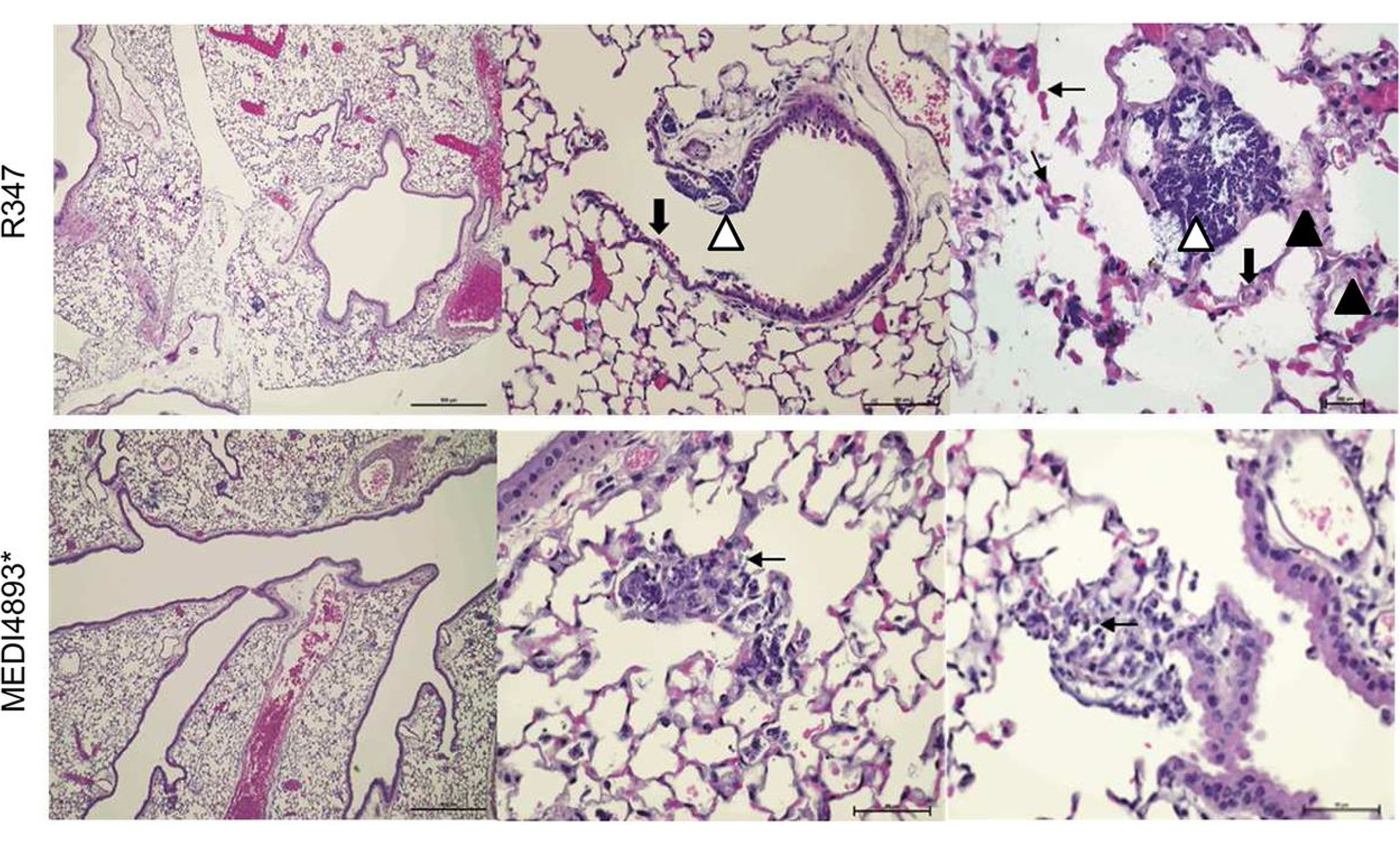 NeutraAb™ Human Anti-Staphylococcus Aureus Alpha Toxin Monoclonal ...