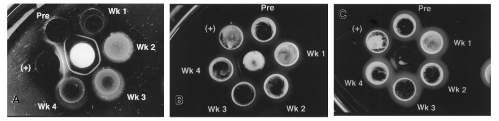 AGP Test - Creative Diagnostics