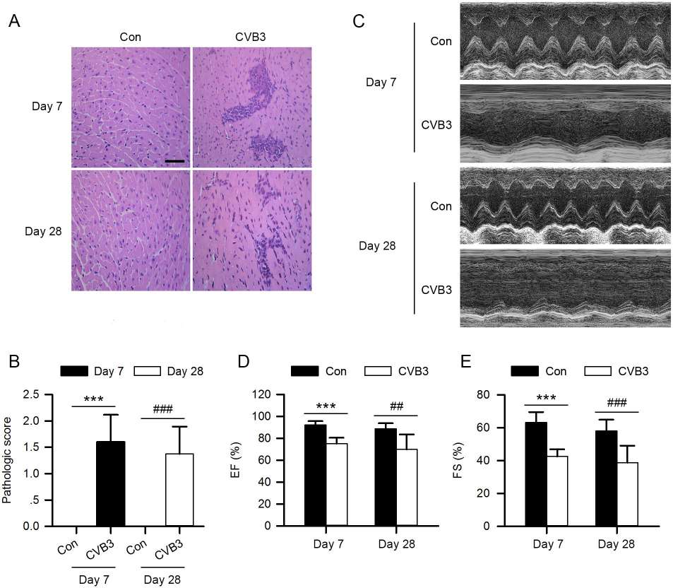 CV B3 Intraperitoneal Infection Mouse Model - Creative Diagnostics