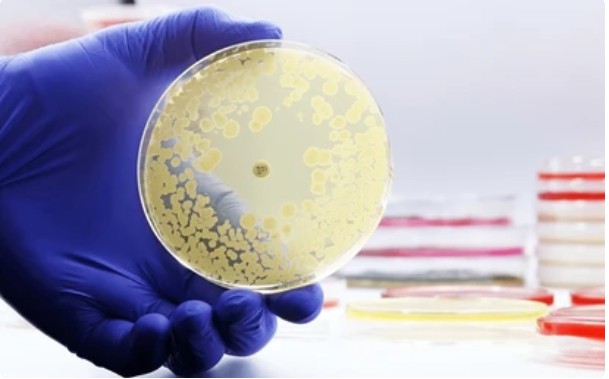 Drug-Resistant Strain Isolation & Identification - Creative Diagnostics