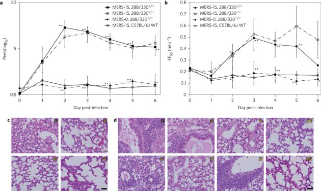 MERS-CoV Mouse Model - Creative Diagnostics