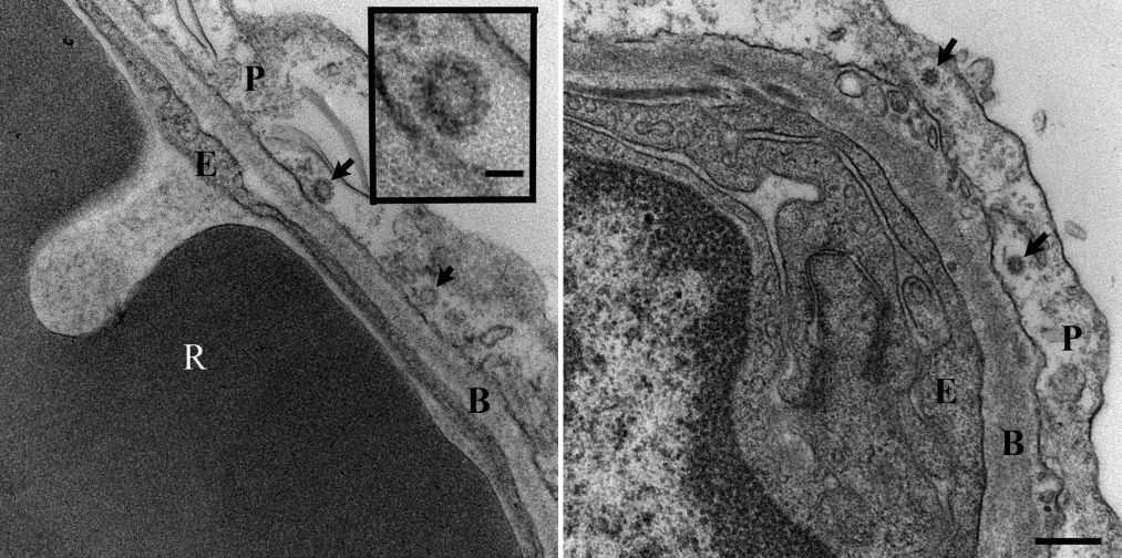 MERS-CoV Monkey Model - Creative Diagnostics