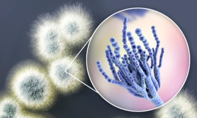 Microbial Identification and Typing - Creative Diagnostics