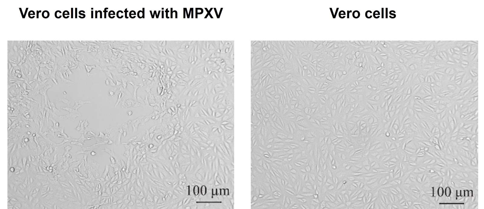 MPXV Neutralizing Antibody Test - Creative Diagnostics