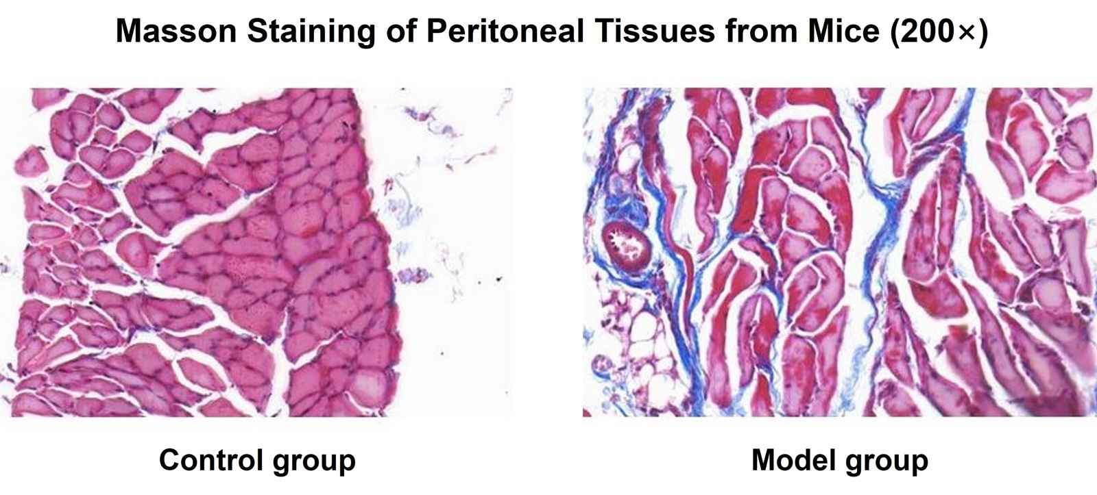 Peritoneal Fibrosis Disease Models - Creative Diagnostics