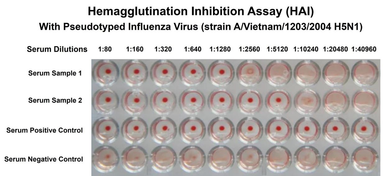 Custom Pseudotyped Reporter Virus for Influenza - Creative Diagnostics