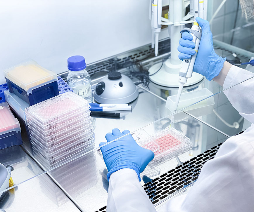 Recombinant Protein Vaccine Development CRO - Creative Diagnostics